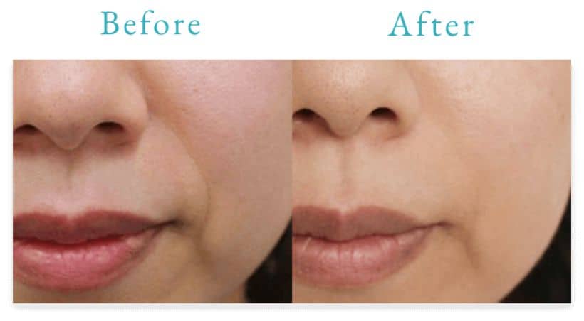 Blu Clinic. - Epilation Specialty Clinic Since2022